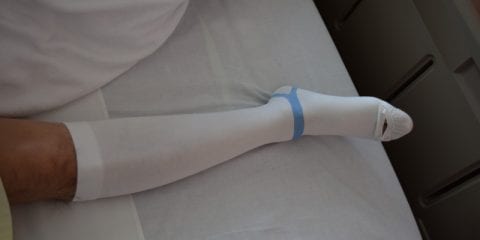 Benefits of Compression Hose | York Foot Orthotics and Bracing