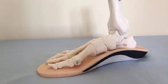 How Do Custom-Made Orthotics Compare to Over-the-Counter Orthotics ...